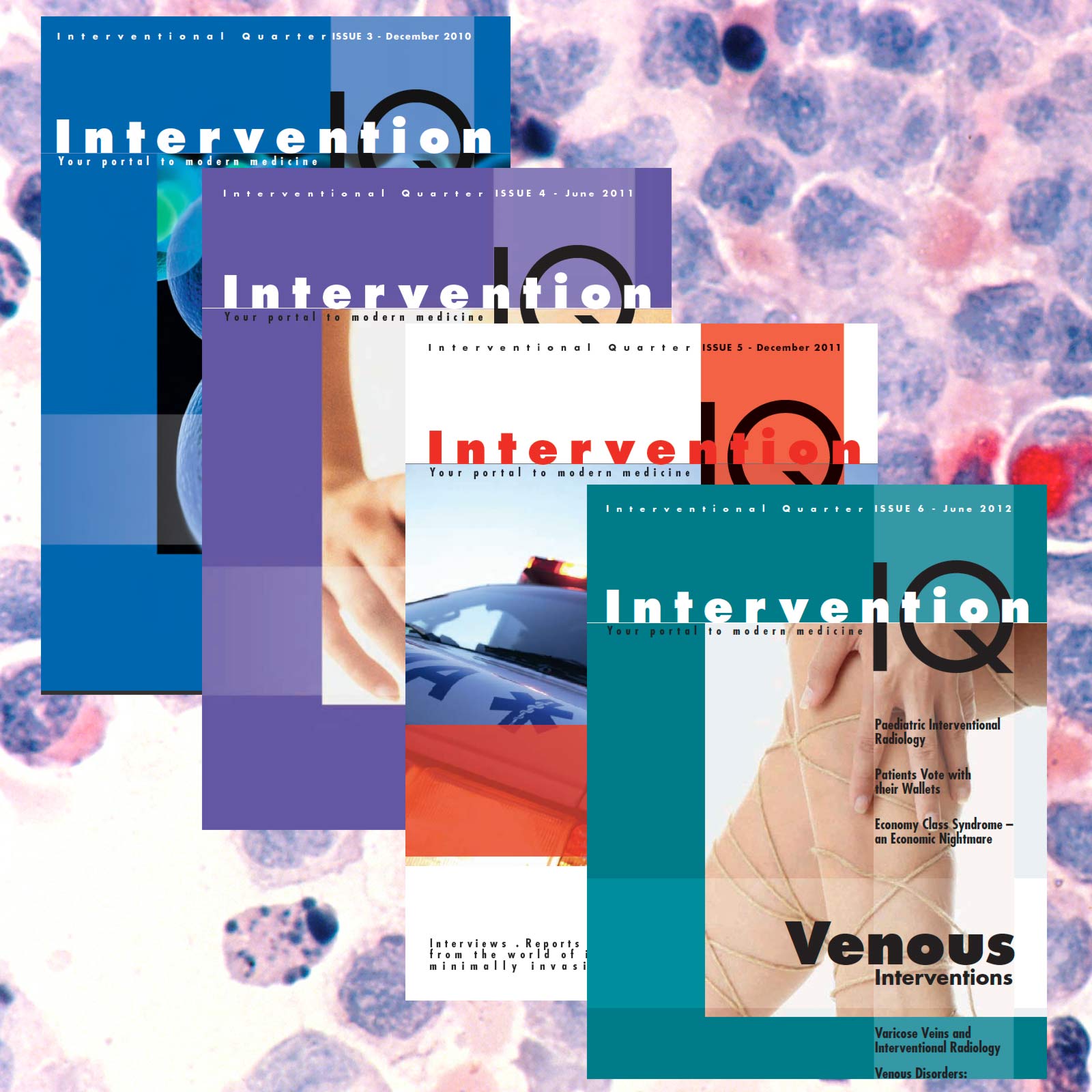 Digital Magazine Publishing Platform, Intervention IQ